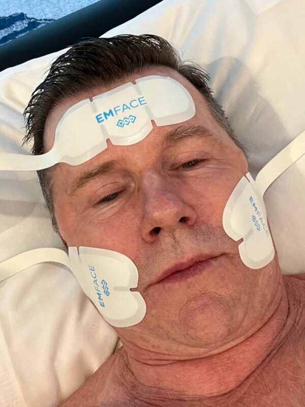 Emface Nonsurgical Facelift for Los Gatos & Campbell, CA - RefinedMD