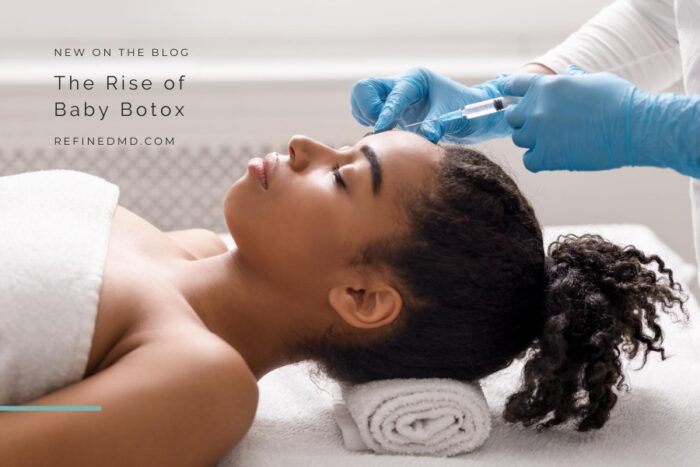 The Rise of Baby Botox | RefinedMD, Los Gatos + San Jose