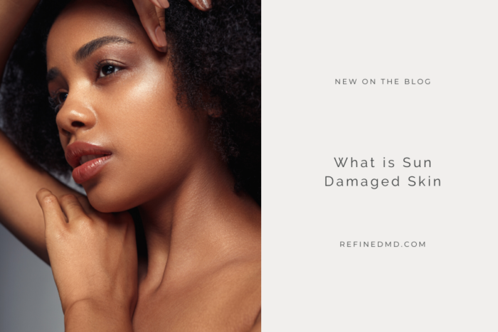 What is Sun Damaged Skin? | RefinedMD, Los Gatos + San Jose