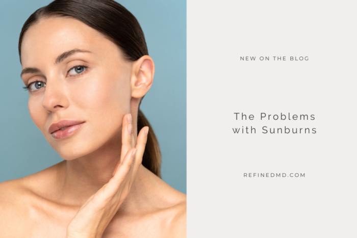 The Problems with Sunburns | RefinedMD, Los Gatos + San Jose