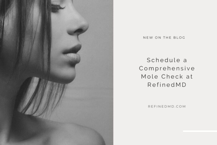 A Comprehensive Mole Check at RefinedMD | RefinedMD, Los Gatos + San Jose